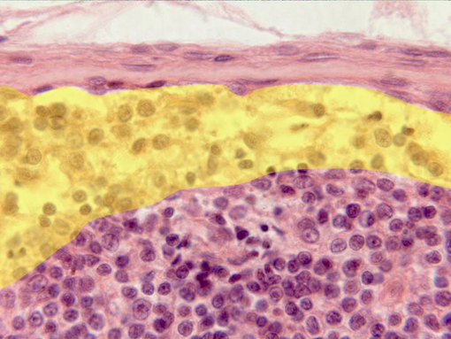 detail of the ganglion capsule and the subcapsular sine observed with ...