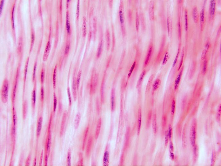 Epidermis