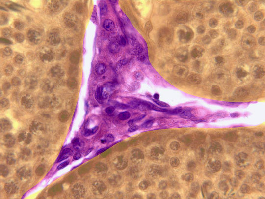 Epidermis