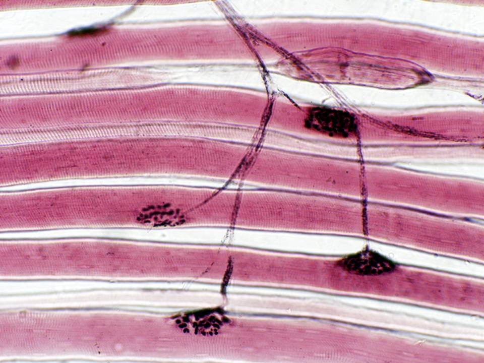 Contracción muscular