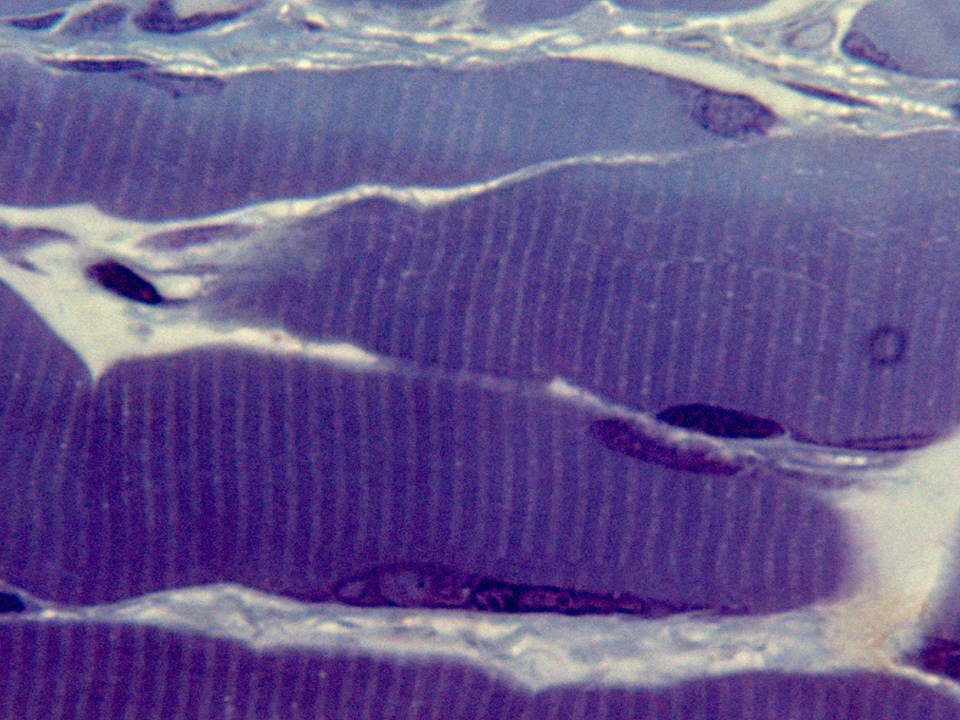 Muscular estriado II